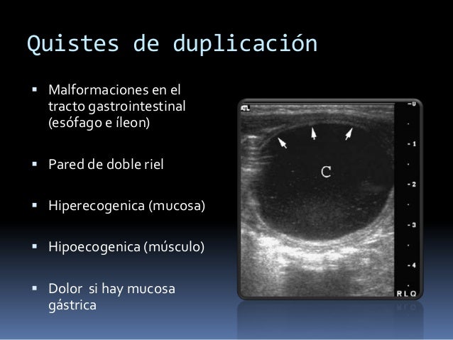 Adenitis Mesenterica Nios Pdf